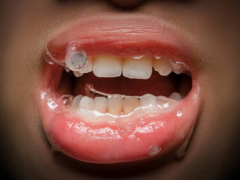 Le rôle de la salive dans la protection de la cavité buccale